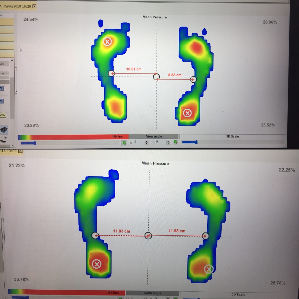 Henry's Acute Back Pain Flare Up · Ellie Williams – Move Well